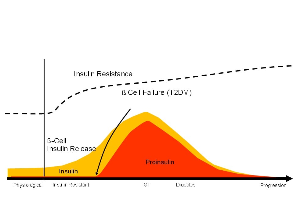 Pathways of Diabetes: Beta cell dysfunction and insulin signalling