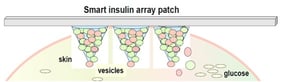Smart Insulin Patches or Glucose-Responsive Insulin Delivery Systems